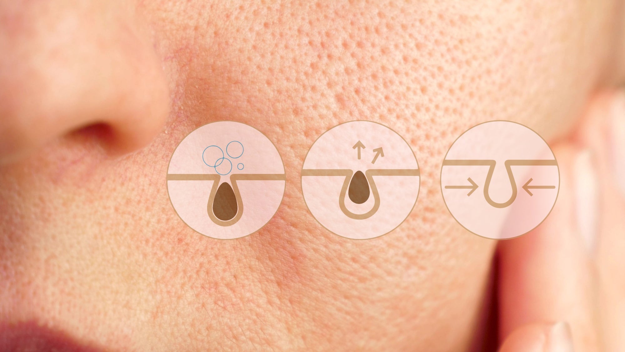 How to Minimize Pores on Your Face: Top Tips for Smooth, Clear Skin ...